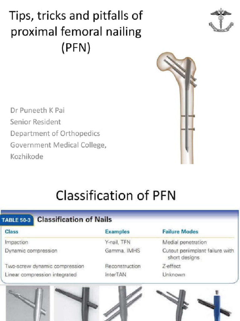 Tips, Tricks and Pitfalls of Proximal Femoral Nailing (PFN) - 20240629_081100 | PDF