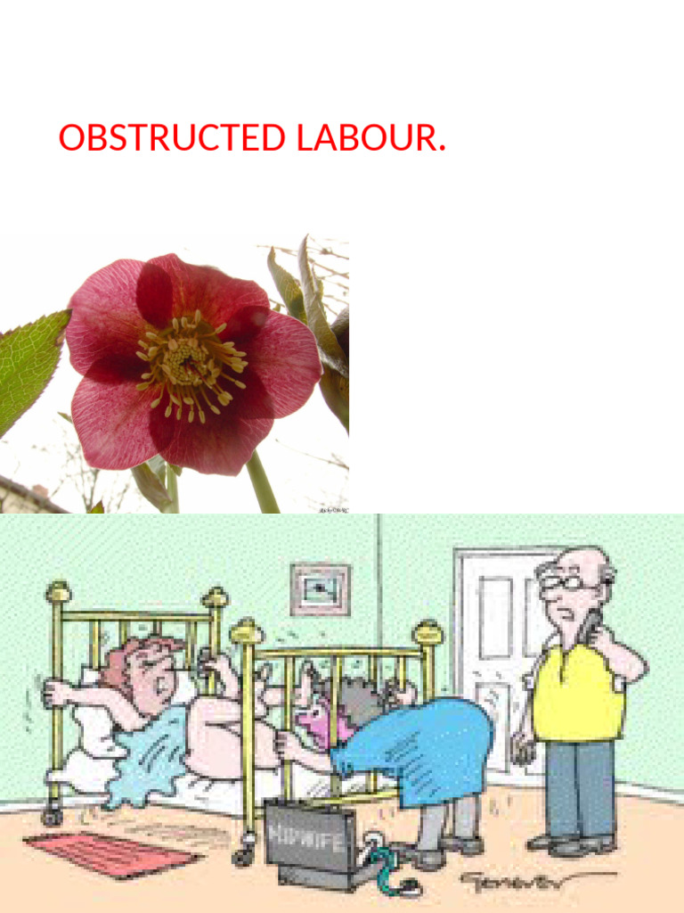 Obstructed Labour | PDF