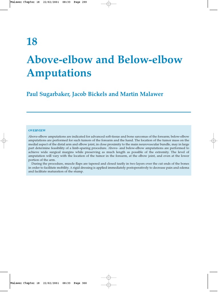 Above Elbow and Below Elbow Amputation | PDF | Amputation | Arm