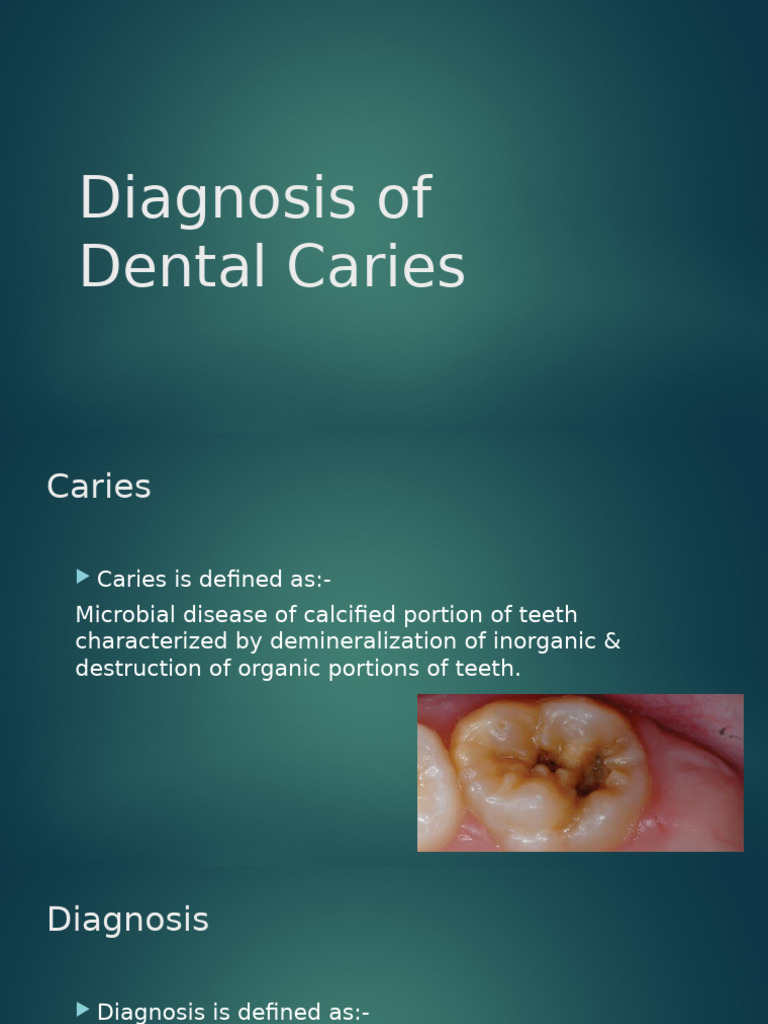 Diagnosis of Dental Caries (Final) | PDF