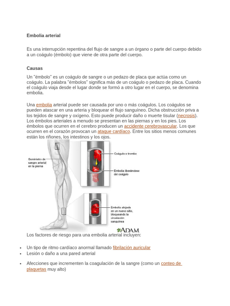 Embolia Arterial | PDF