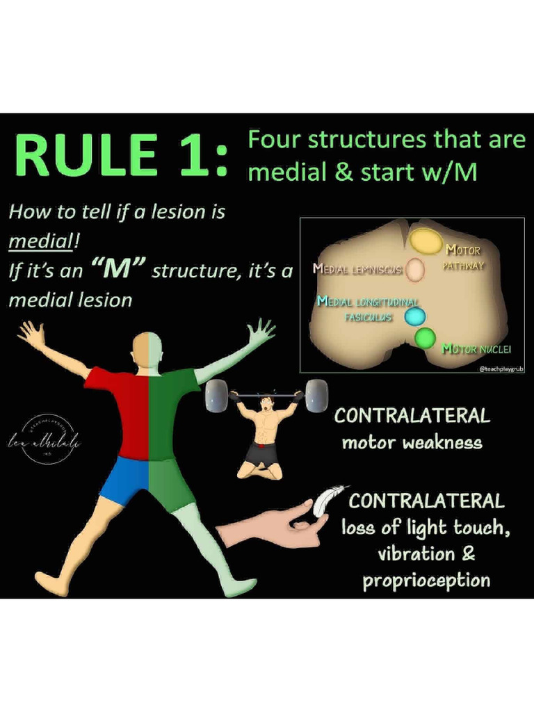 Brain Stem..Rule of 4 | PDF