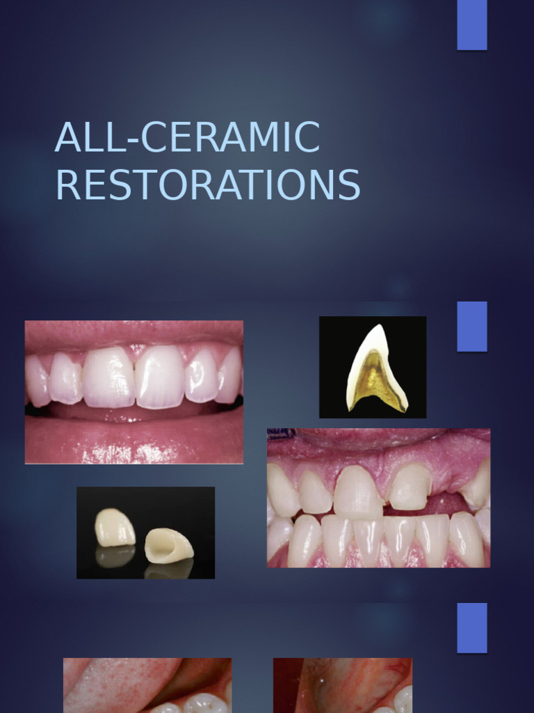 7 - All-Ceramic Restorations | PDF