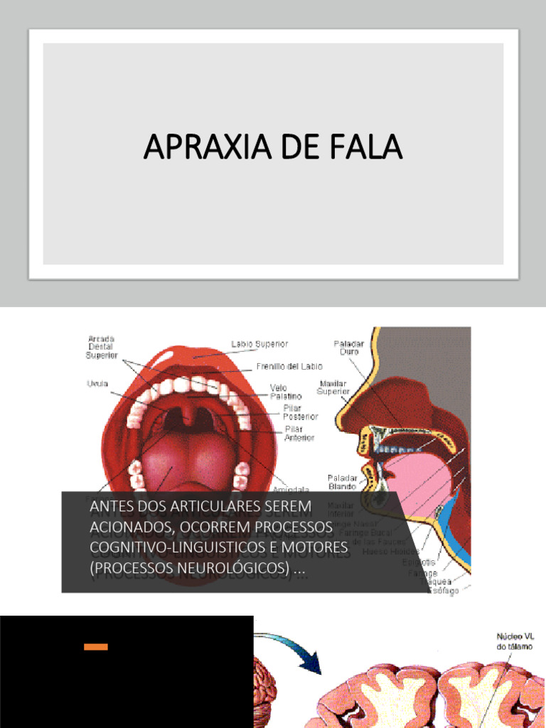 Entendendo a Apraxia de Fala: Causas e Tratamento | PDF | Aprendizado ...
