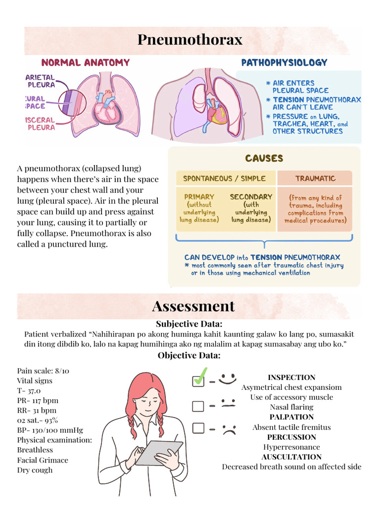 Pneumothorax Notes | PDF