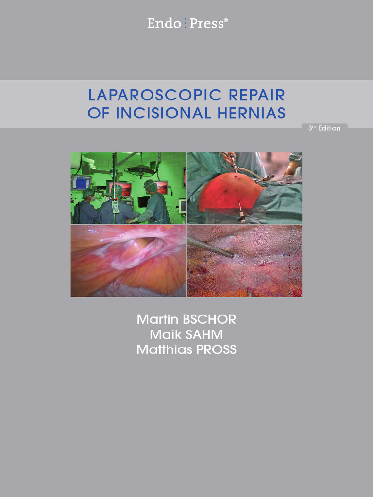 Lap Hernia Repair Procedure Step | PDF | Surgical Suture | Scar