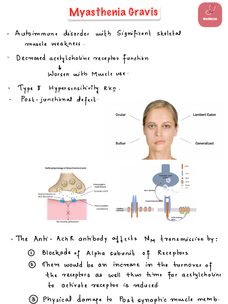Myasthenia Gravis | PDF