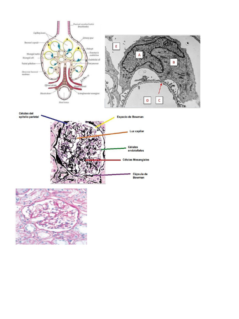 Imagenes de nefro | PDF
