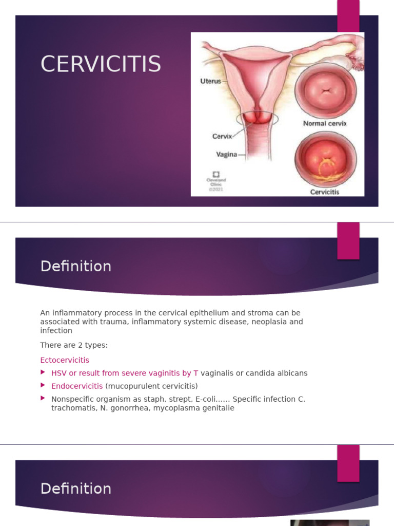 Cervicitis | PDF