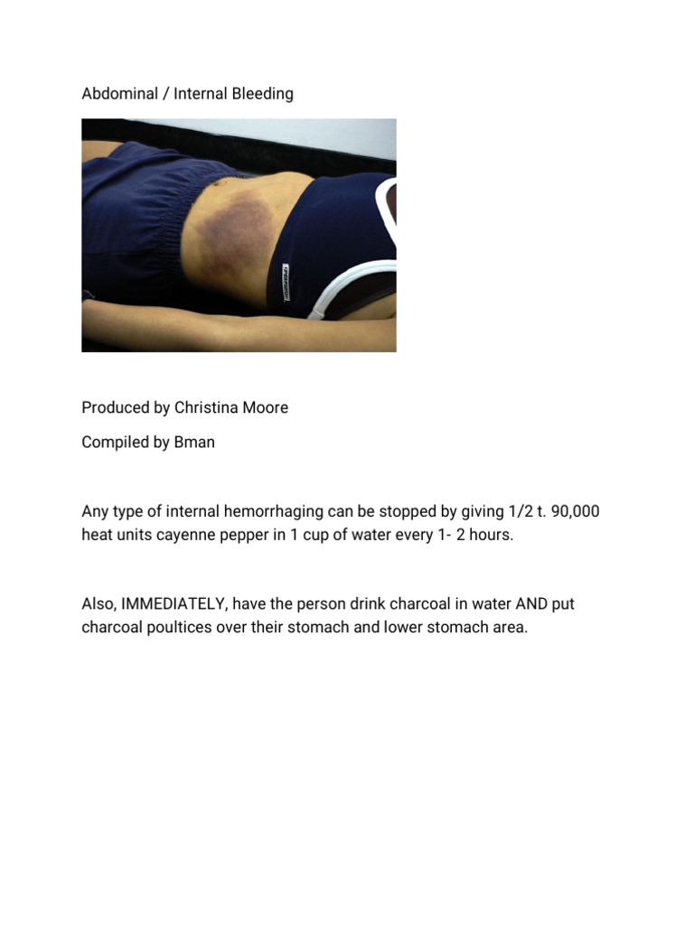 Abdominal Internal Bleeding | PDF