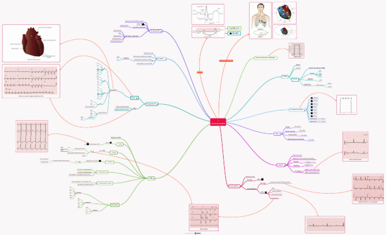 Lendo Ecg Mapa Mental de Materia de Urgencia e Emergencia Páginas Excluídas | PDF