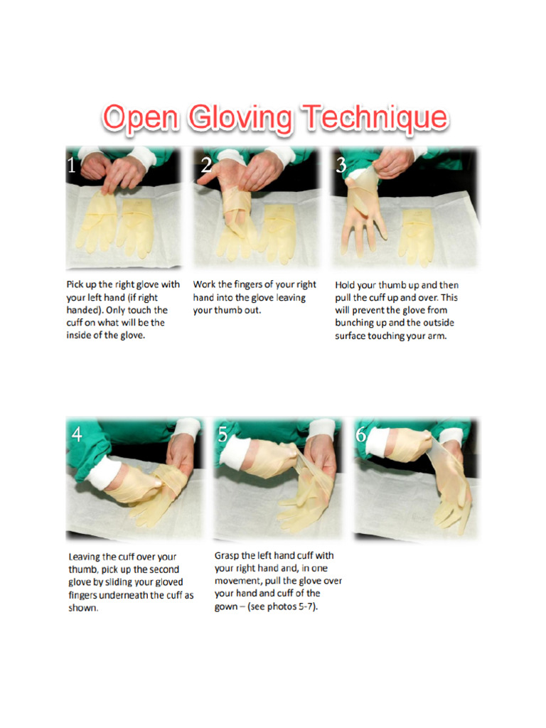 Close and Open Gloving | PDF
