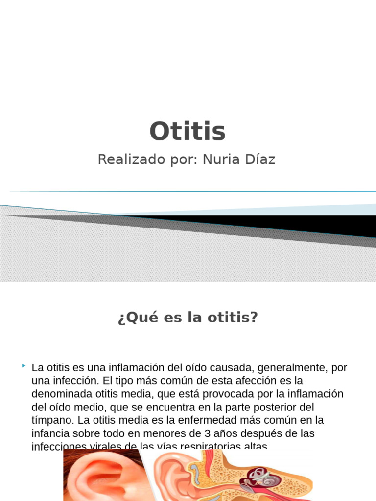 Otitis | PDF