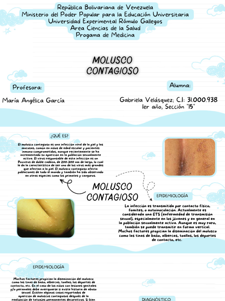Molusco Contagioso - 20240716 - 172403 - 0000 | PDF