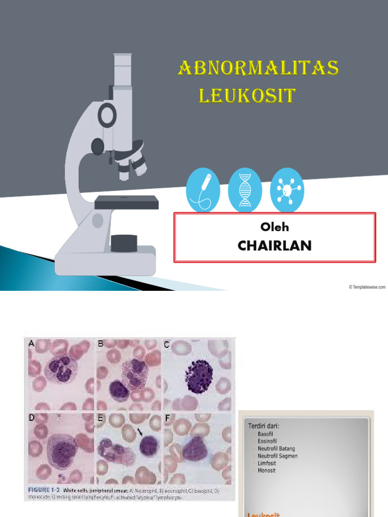 MATKUL HEMATLOGI T SMT 3 (Abnormalitas Leukosit) | PDF