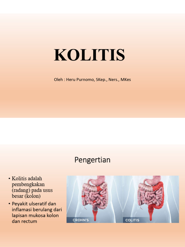 Kolitis | PDF
