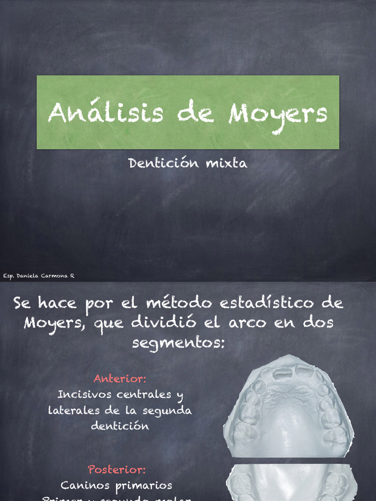 Análisis de Moyers | PDF