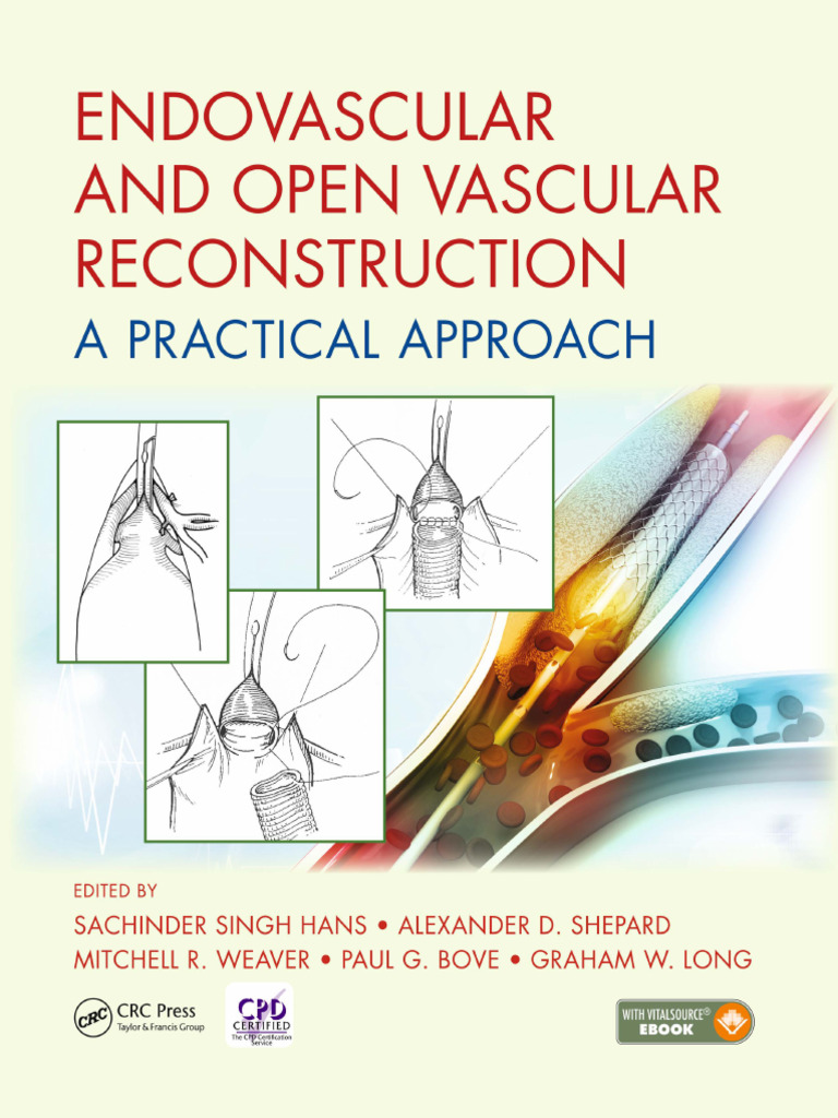 Open Vascular Reconstruction | PDF
