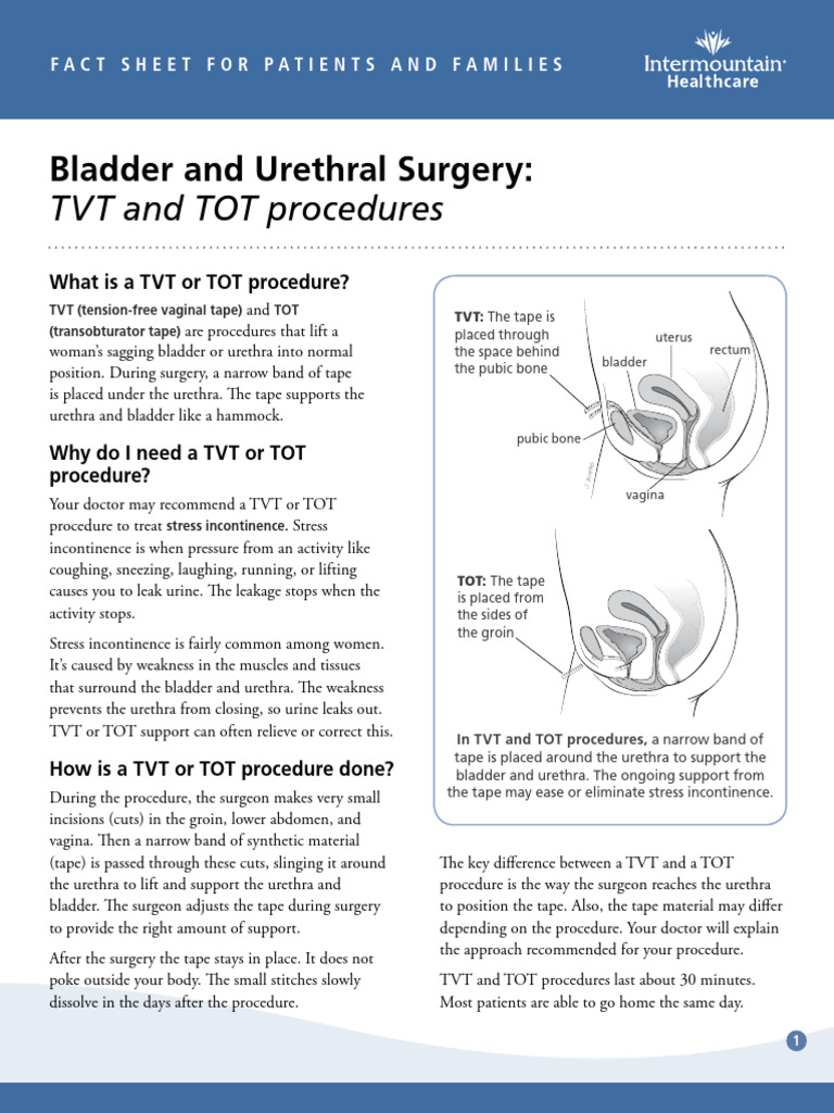 Bladder and Urethral Surgery TVT and TOT Procedures Fact Sheet | PDF ...