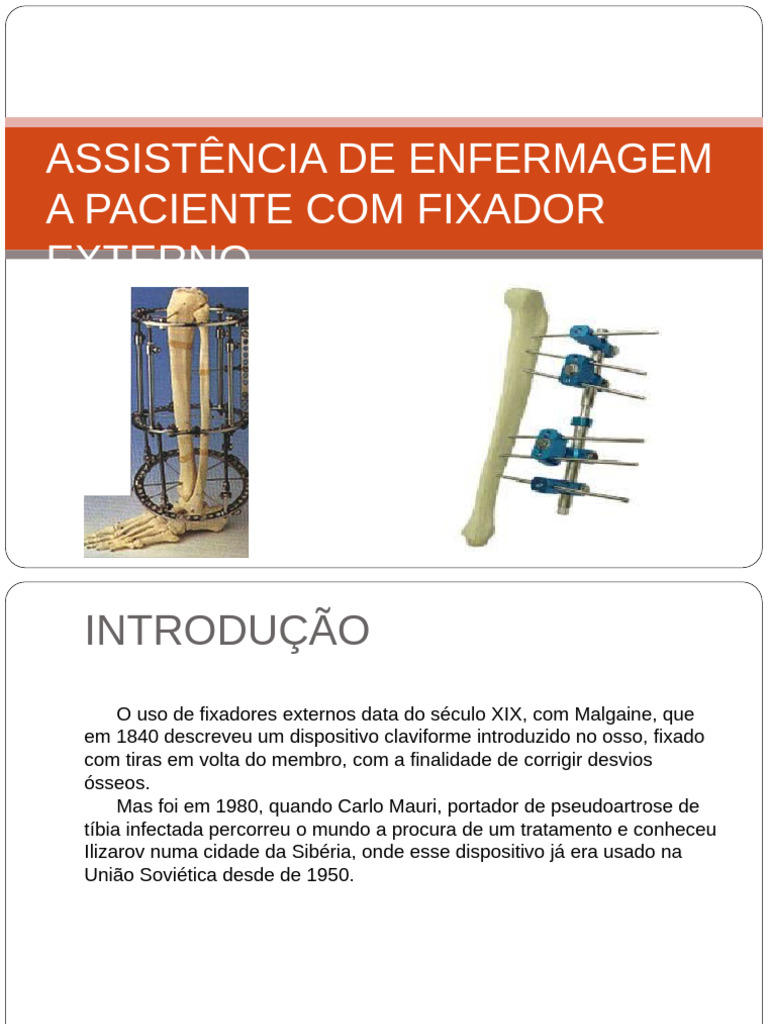 Fixador Externo | PDF