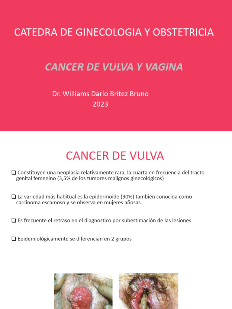 Patología Vulvovaginal | PDF
