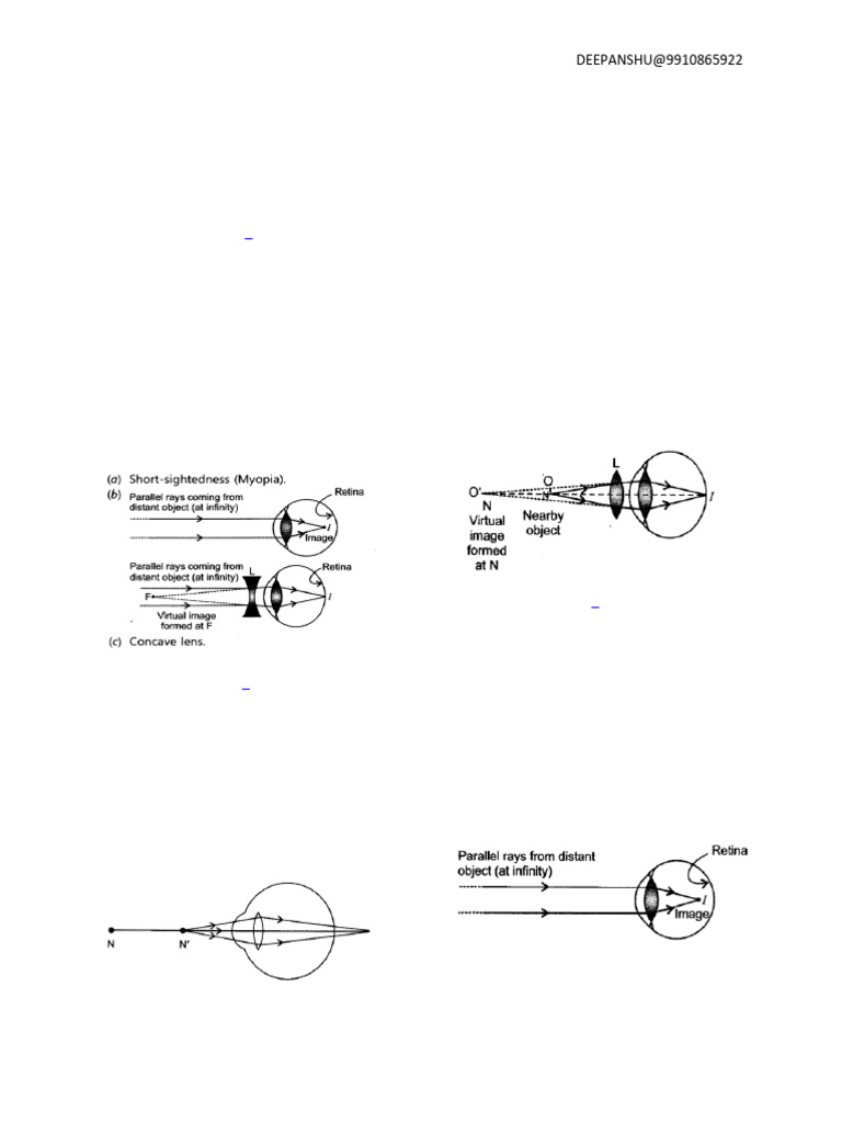 Chapter 11 Human Eye | PDF