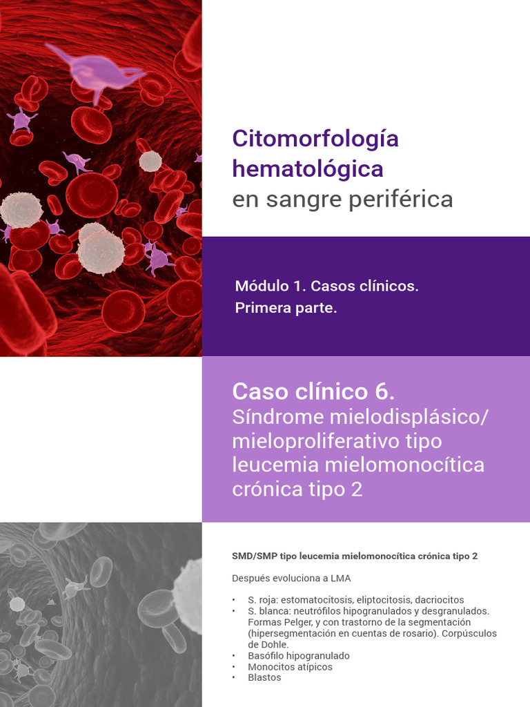 LMMC Tipo 2 | PDF