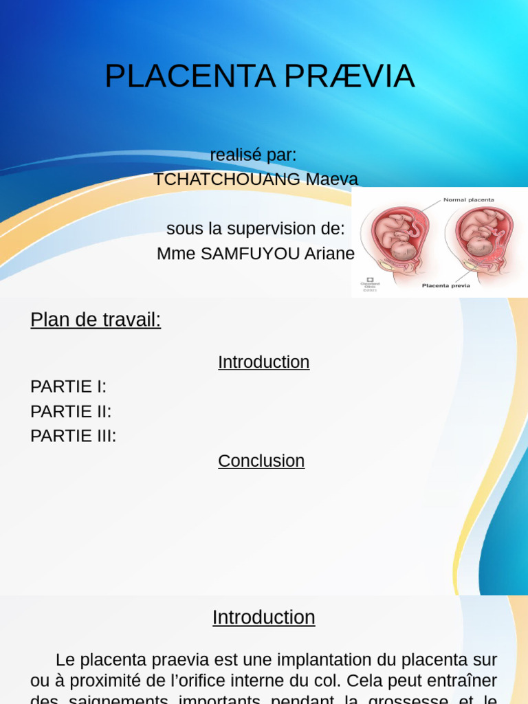 Placenta Prævia Présentation | PDF