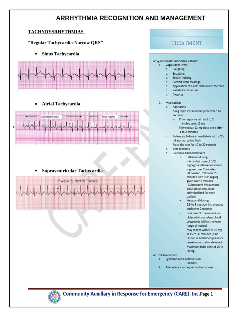 Chapter 3 Arrhythmias and Management | PDF