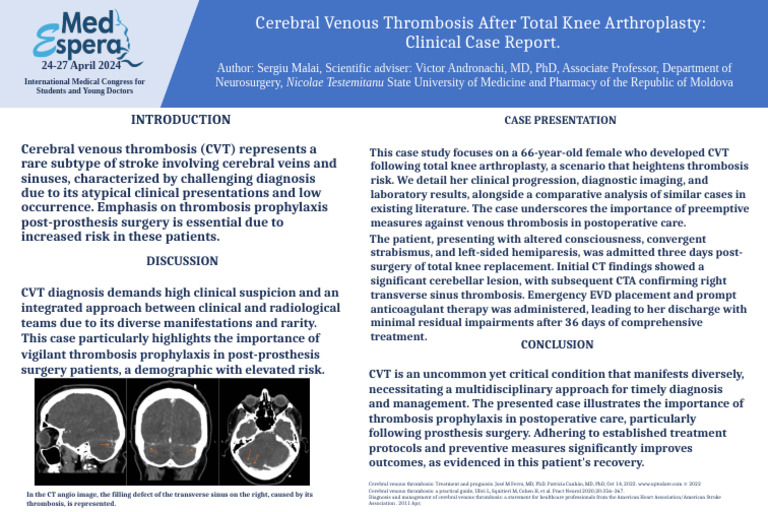 Cerebral Venous Thrombosis Case Presentation | PDF