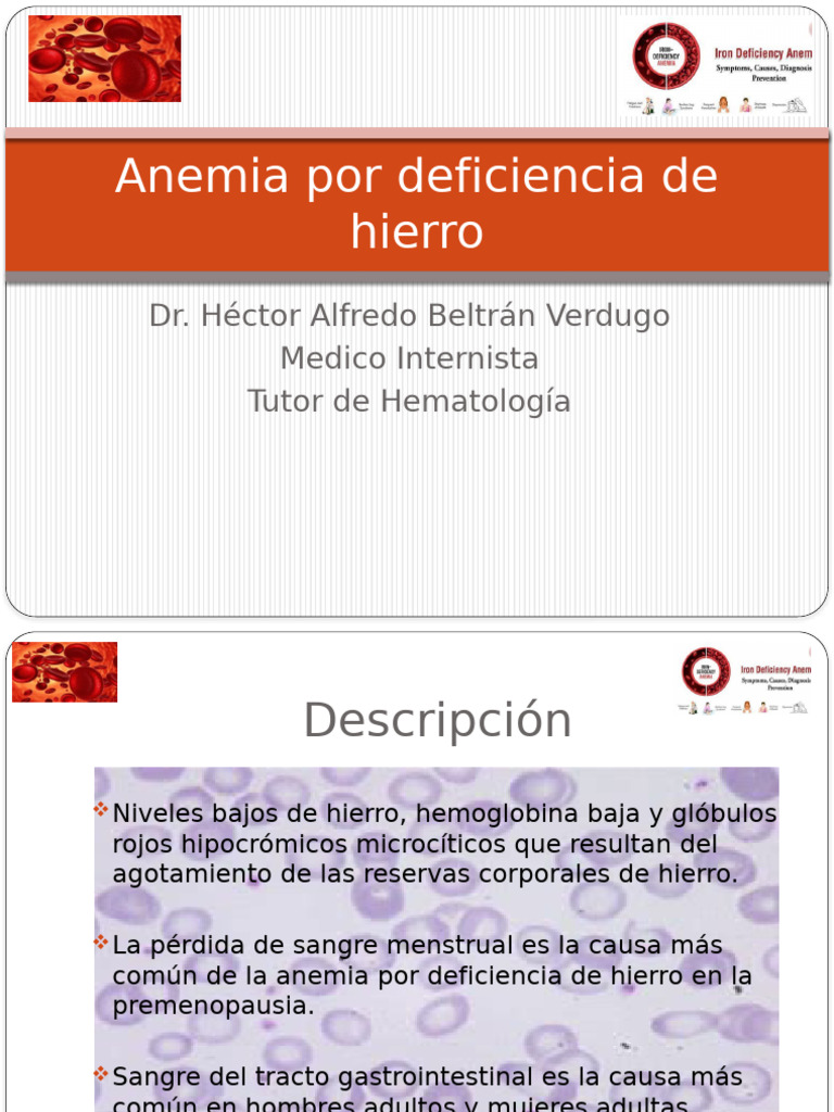 Anemia por Deficiencia de Hierro: Causas y Tratamiento | PDF ...