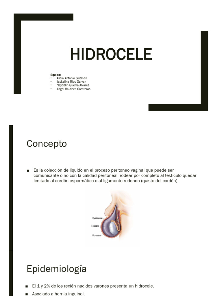 Hidrocele 1 Pdf