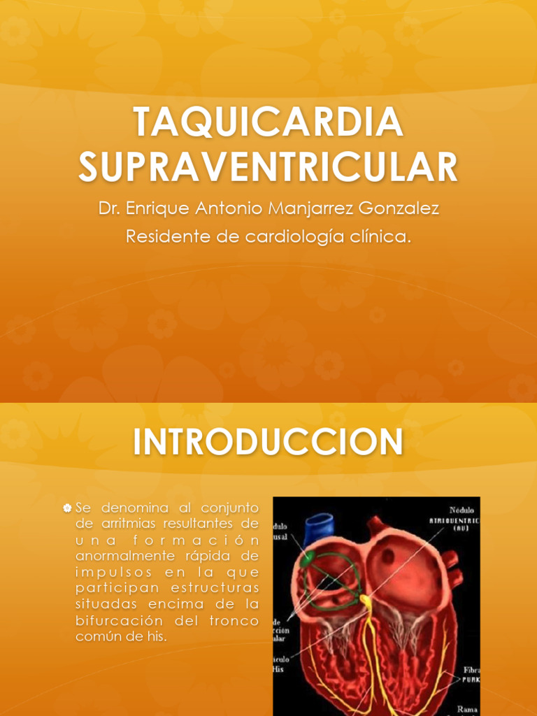 Taquicardia Supraventricular | PDF