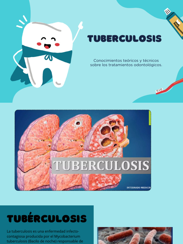 Tuberculosis | PDF