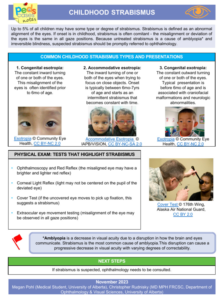Strabismus | PDF