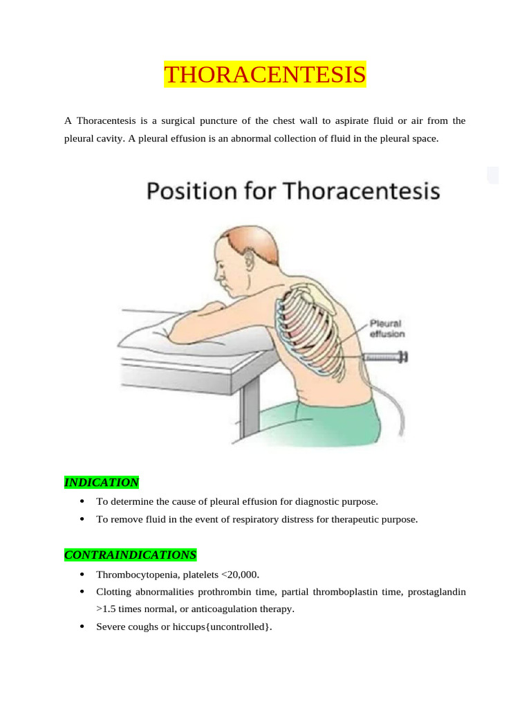 THORACENTESIS | PDF