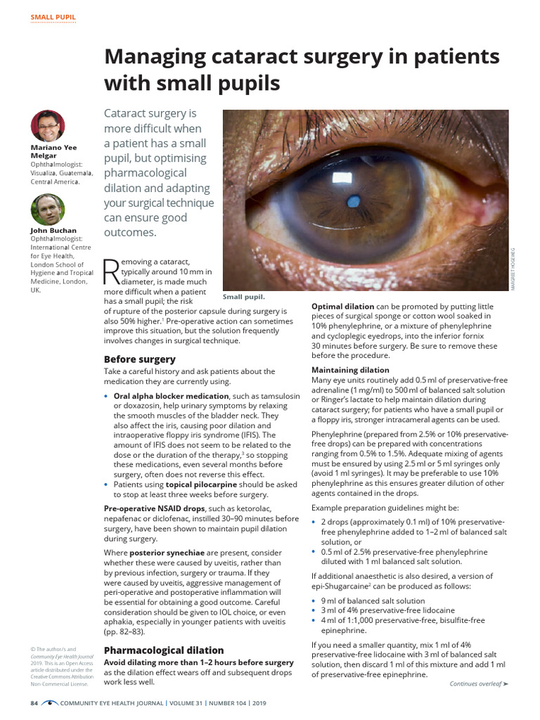 Managing Cataract Surgery in Patients With Small P | PDF