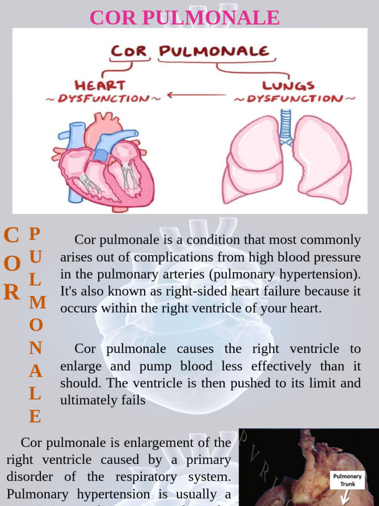 Cor Pulmonale | PDF