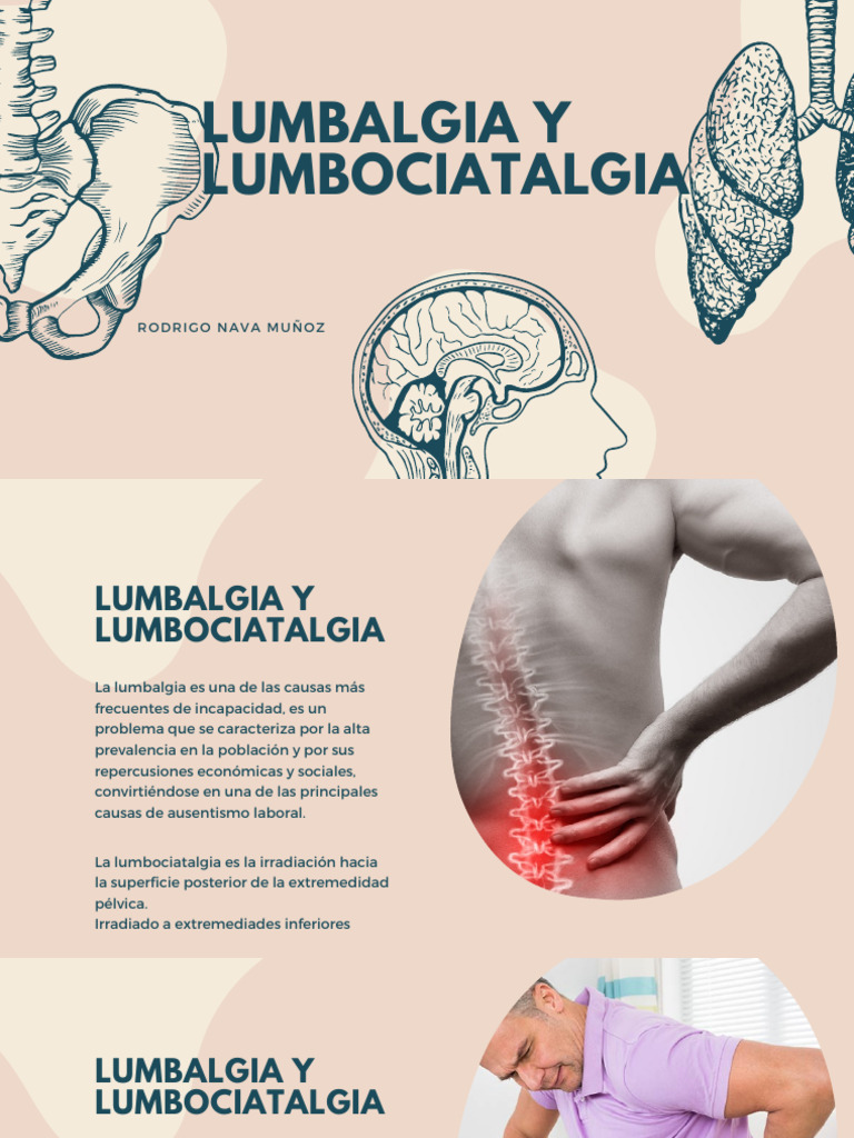 Lumbalgia | PDF