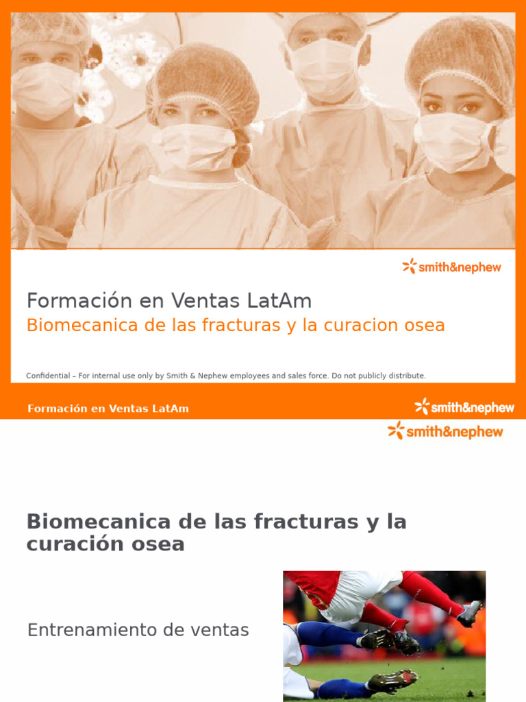 ASD_Spanish_Biomecanica de Las Fracturas y La Curacion Osea | PDF
