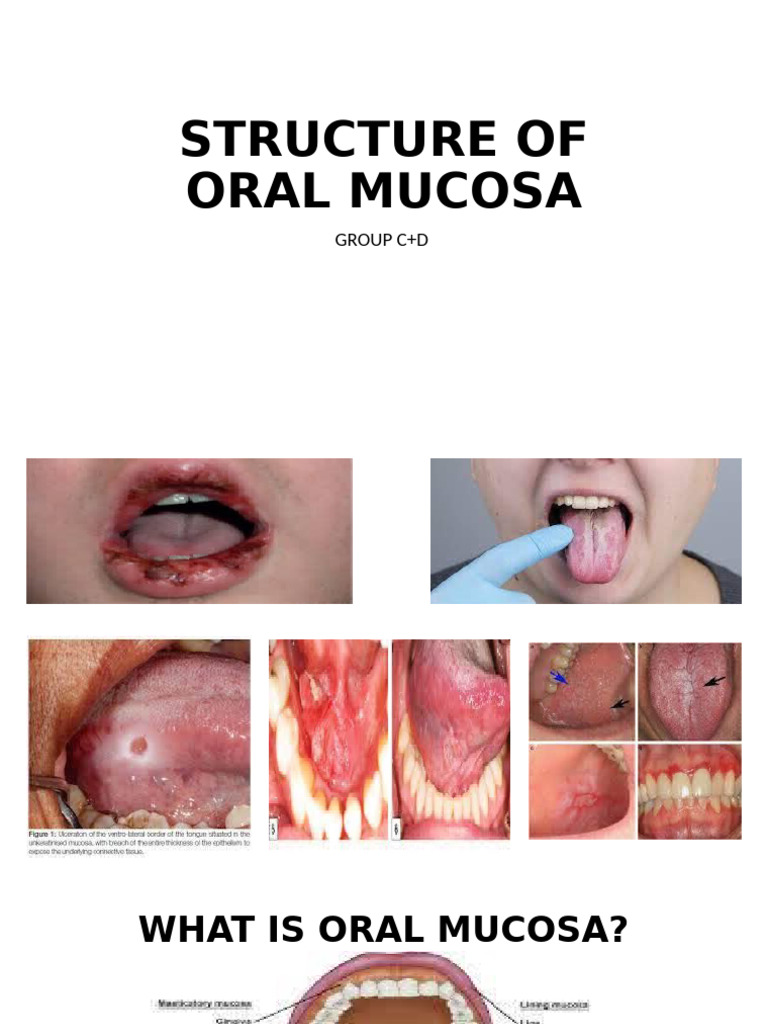 Structure of Oral Mucosa | PDF
