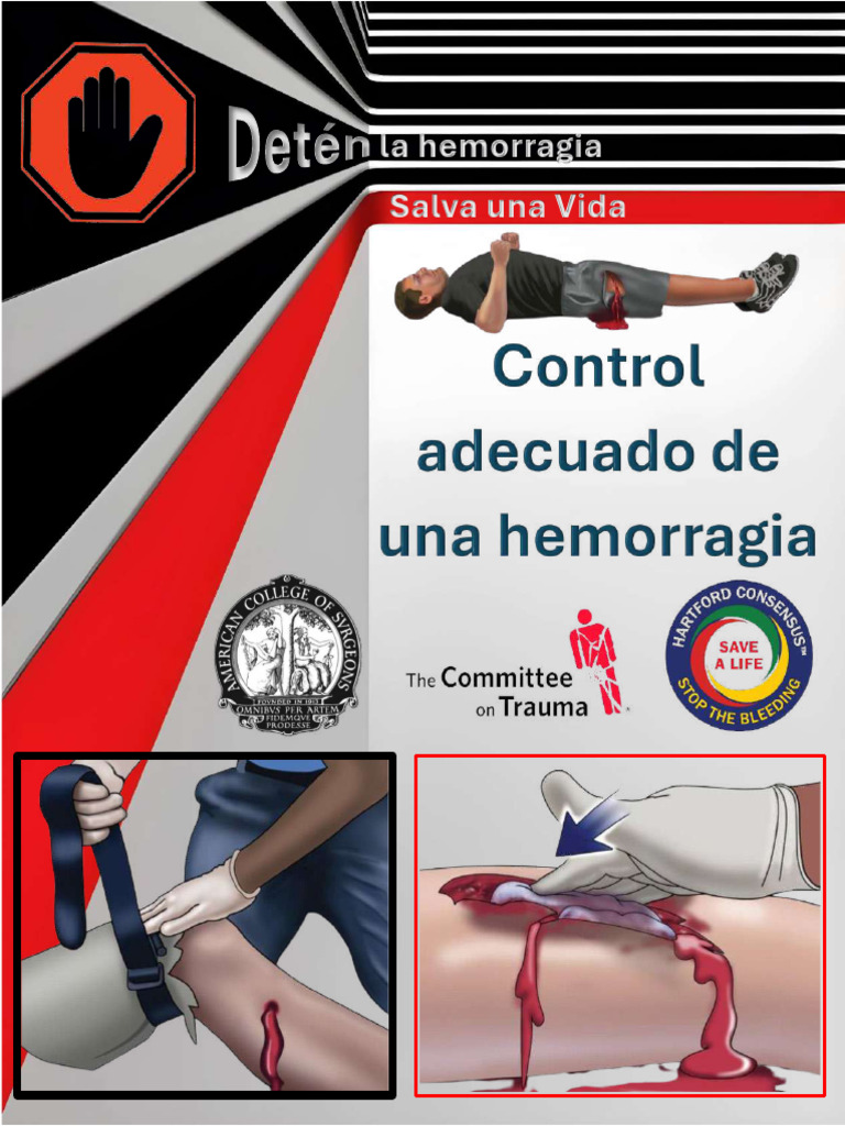 Control Adecuado de Una Hemorragia | PDF | Sangrado | Primeros auxilios