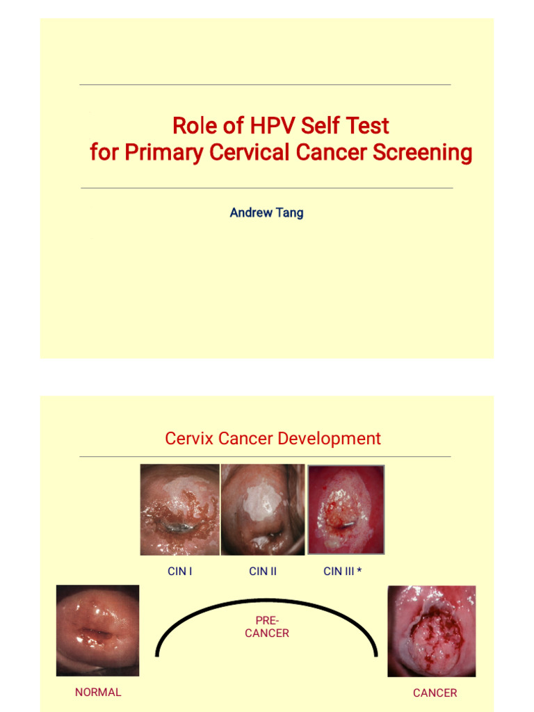 Delphi & HPV 16 - 18 | PDF | Cervical Cancer | Medical Specialties