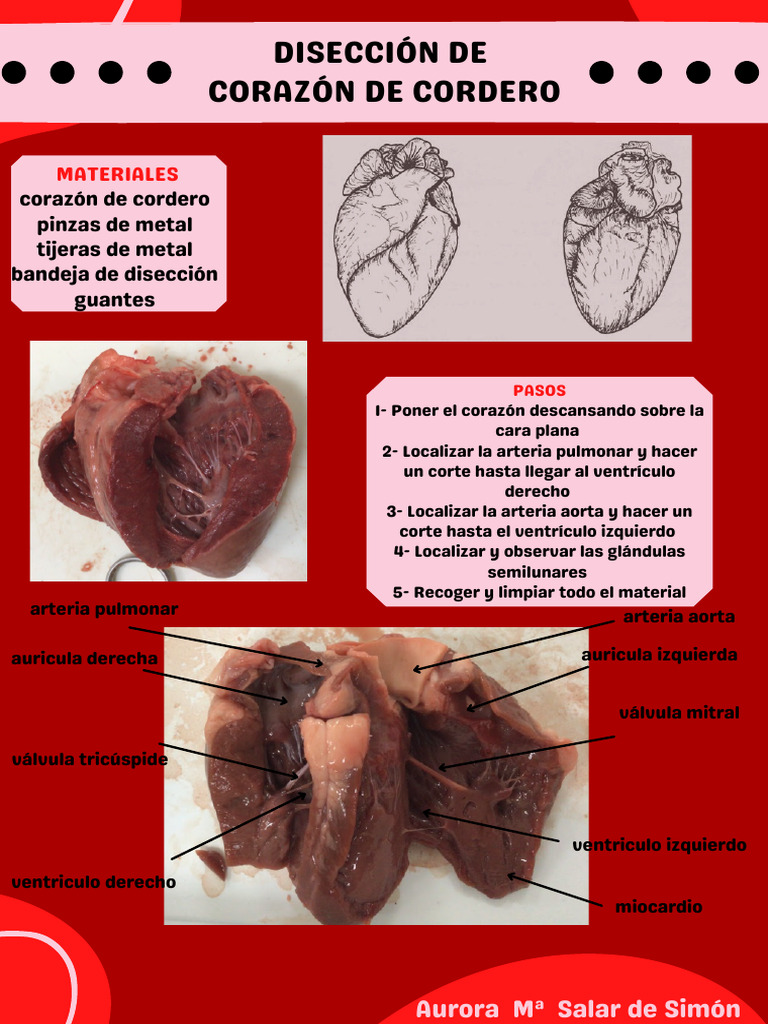Disección de Corazón | PDF