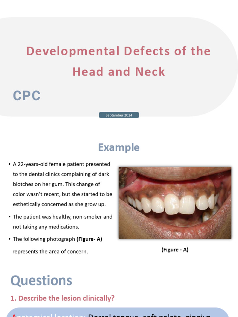 Students CPC Developmental Defects of the Head and Neck Copy | PDF