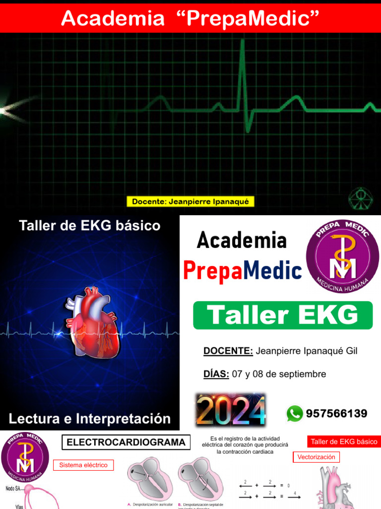 Taller Basico Ekg | PDF