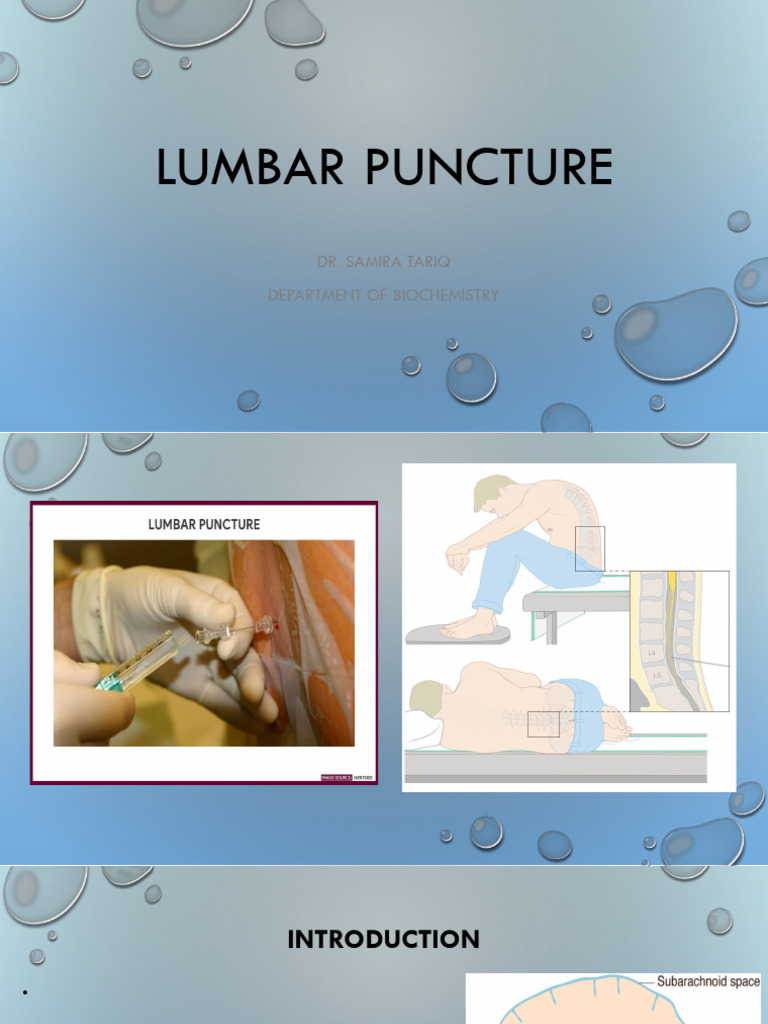 Lumbar Puncture | PDF