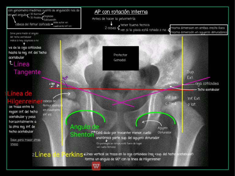 Pelvis Cadera, Femur y Rodilla - 2024 | PDF