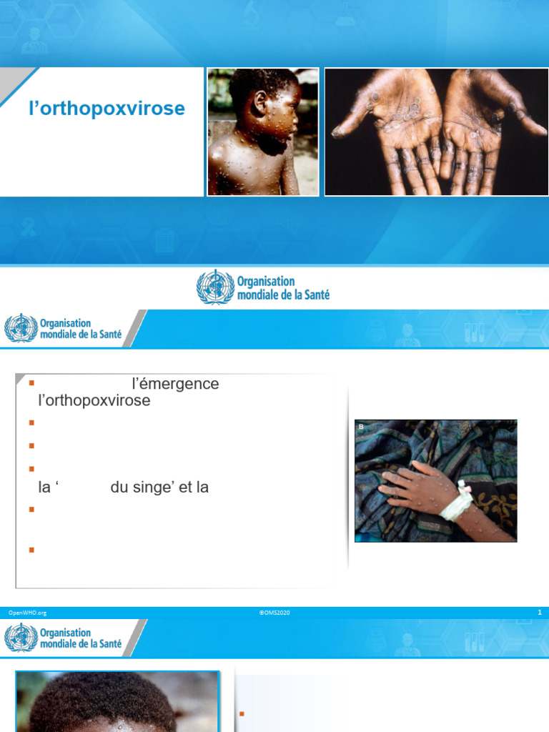 WHO - Monkeypox - COURS Introduction - FR POUR VOTRE INFORMATION | PDF