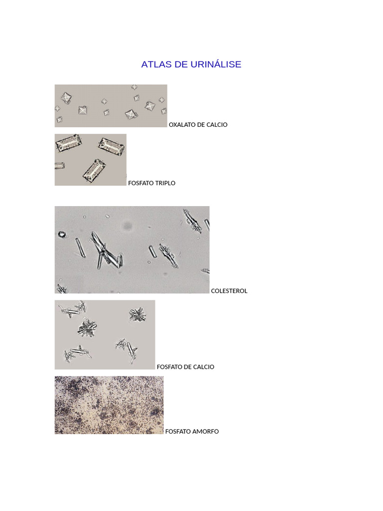 ATLAS DE URINÃ_LISE | PDF